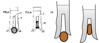 Insulation Displacement: A Breakthrough that Improved your Quality of Life